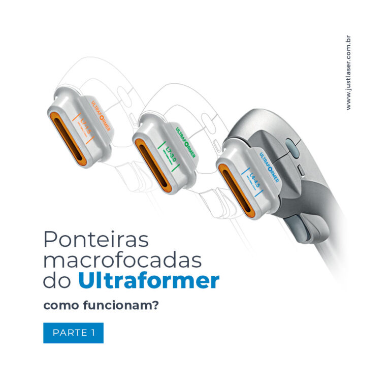 Ponteiras macrofocadas do Ultraformer, como funcionam? Parte 1 | Aluguel de Lasers
