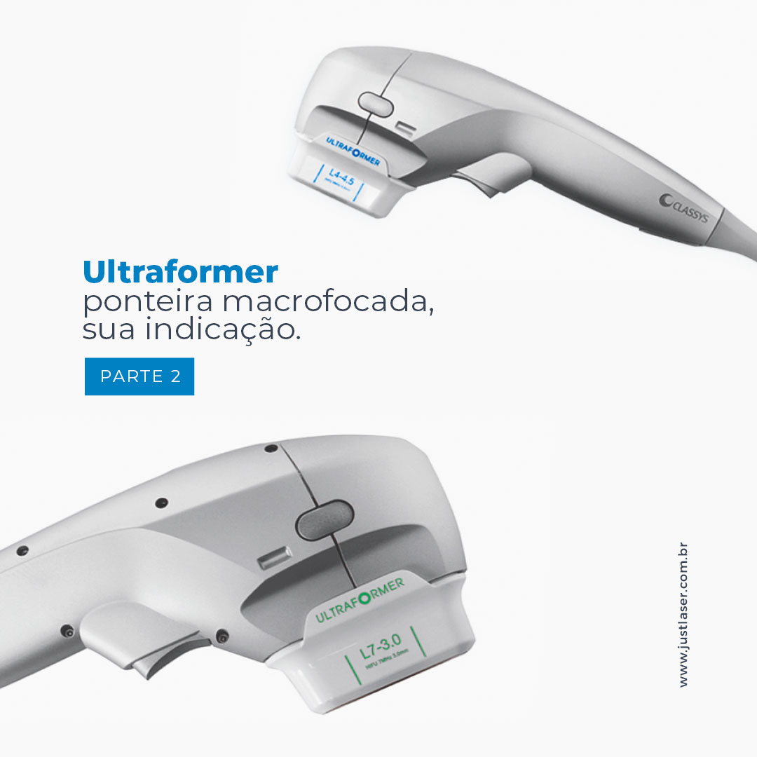 Ultraformer ponteira macrofocada, sua indicação. Parte 2 | Aluguel de ...
