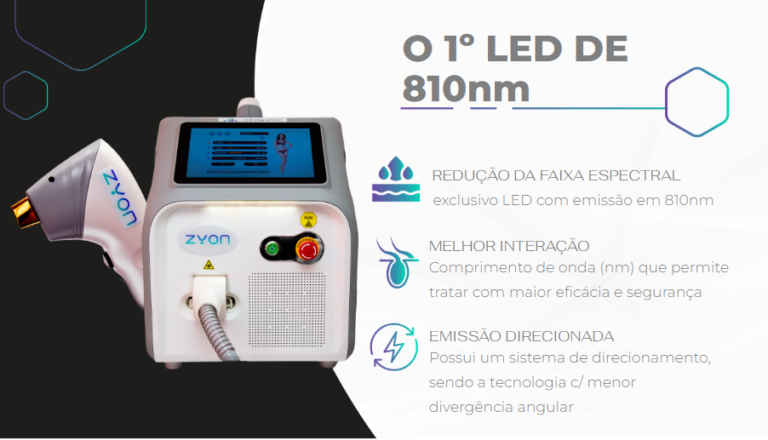 Depilacao a laser Zyon | Aluguel de Lasers