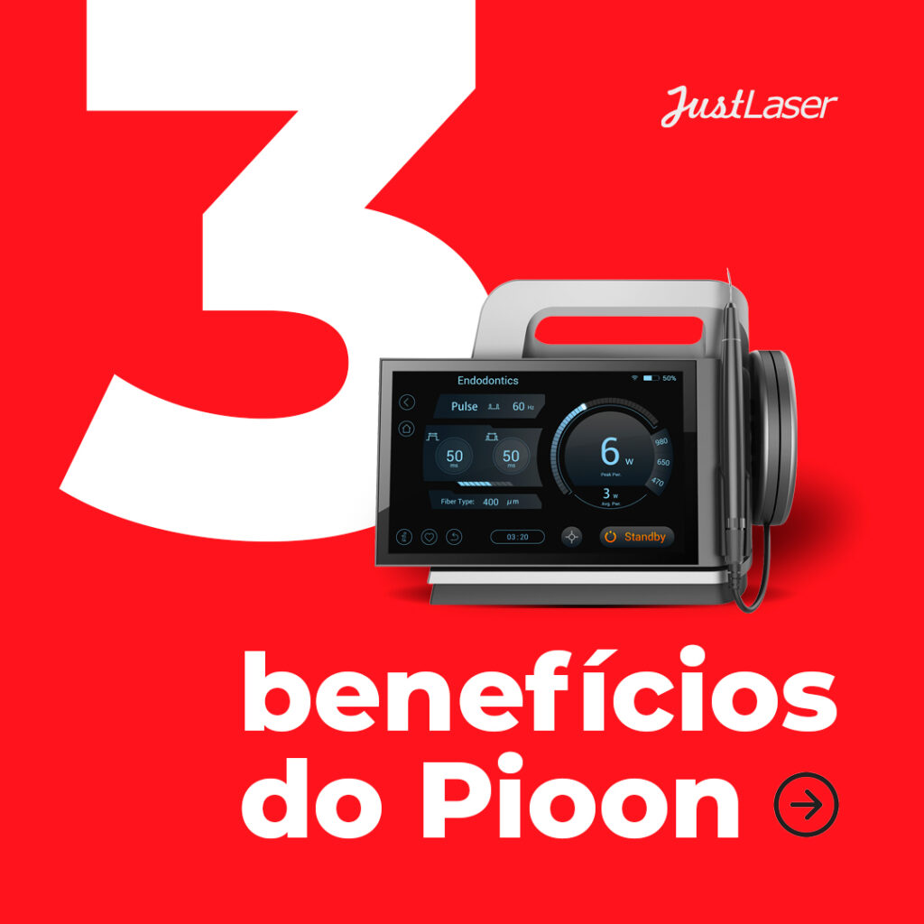 3 benefícios do Pioon | Aluguel de Lasers