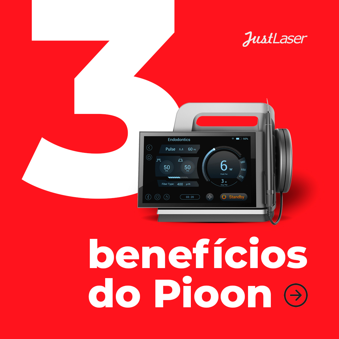 3 benefícios do Pioon | Aluguel de Lasers