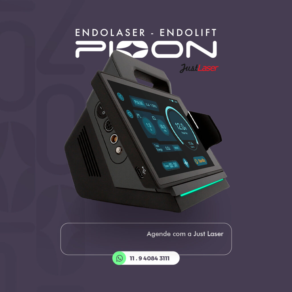 PIOON | Aluguel de Lasers